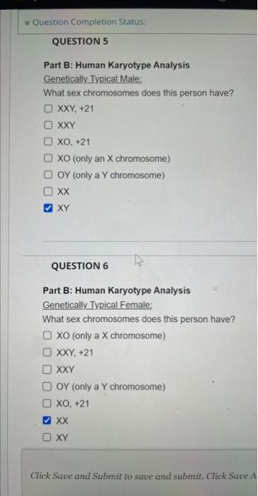 Solved Part B: Human Karyotype Analysis Genetically Typical | Chegg.com Solved Part B: Human Karyotype Analysis Genetically Typical | Chegg.com