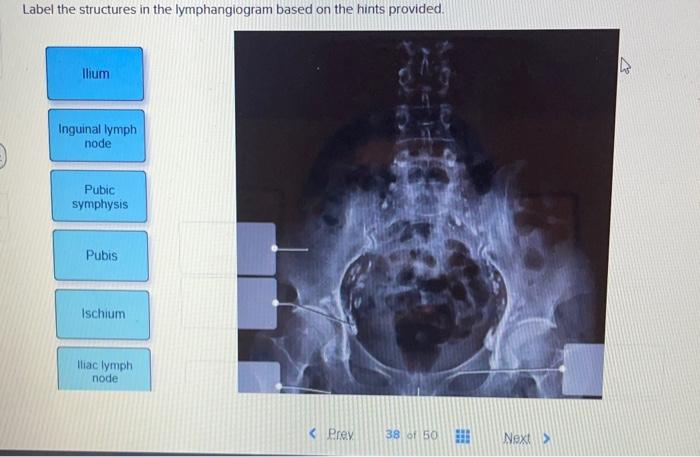 Solved Label the structures in the lymphangiogram based on | Chegg.com