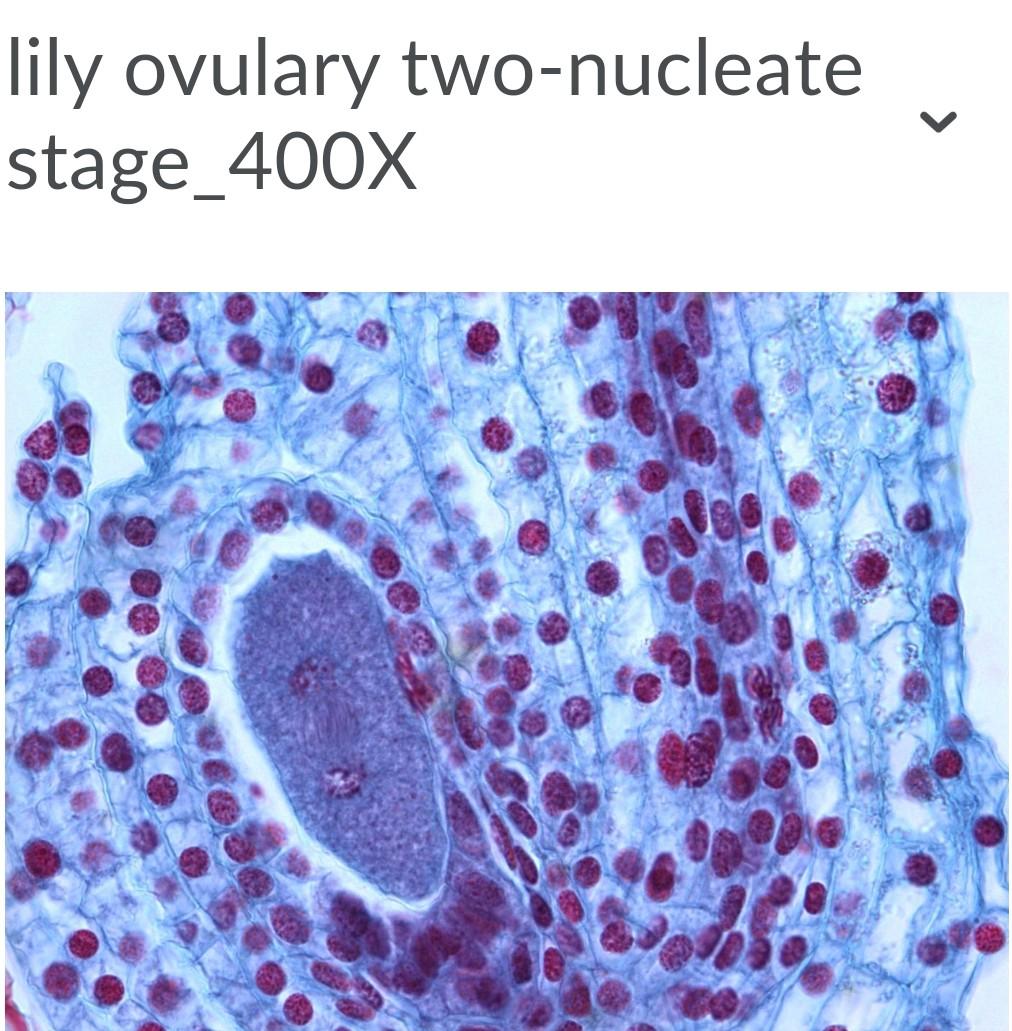 Solved lily ovulary four- nucleate stage_400X lily ovulary | Chegg.com