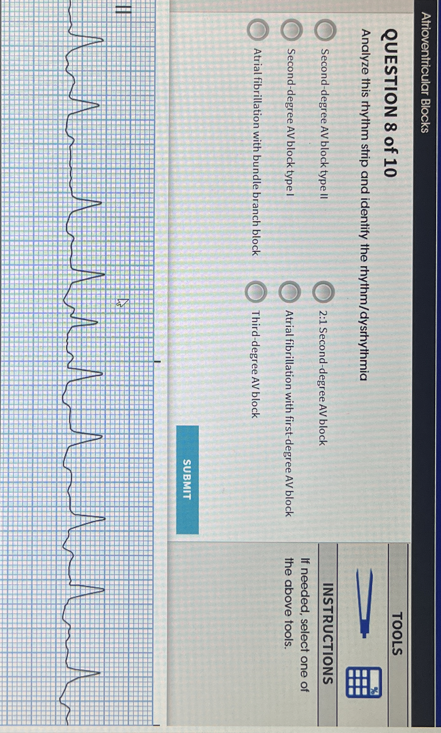 Solved Atrioventricular BlocksQUESTION 8 ﻿of 10Analyze this | Chegg.com