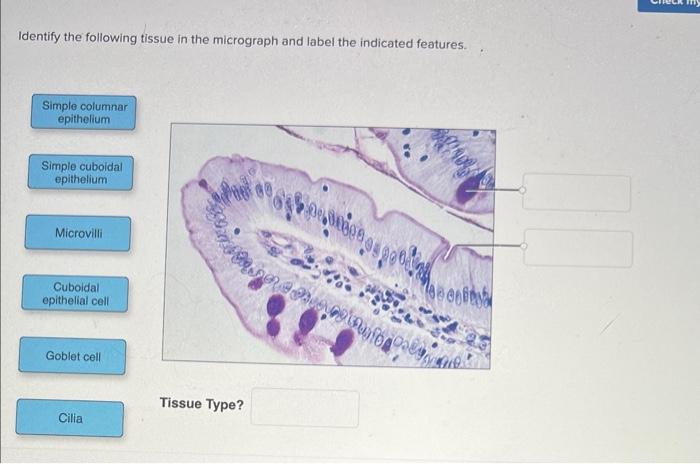 Solved Identify the following tissue in the micrograph and | Chegg.com