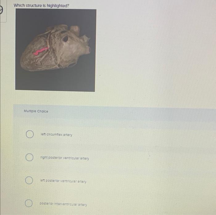Solved Which structure is highlighted? Multiple Choice eft | Chegg.com