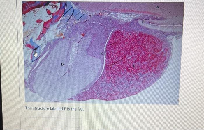 Solved The structure labeled F is the [A]. | Chegg.com