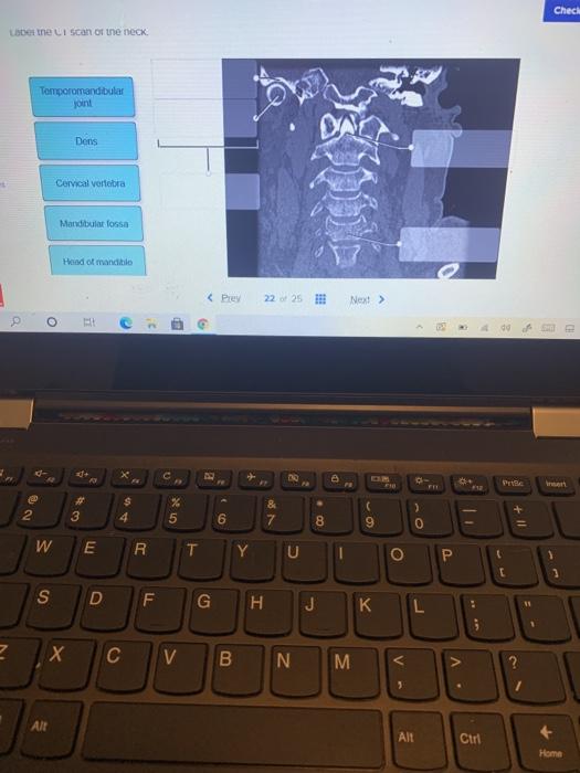 Solved Check Use the ci scan of the neck Temporomandibular | Chegg.com