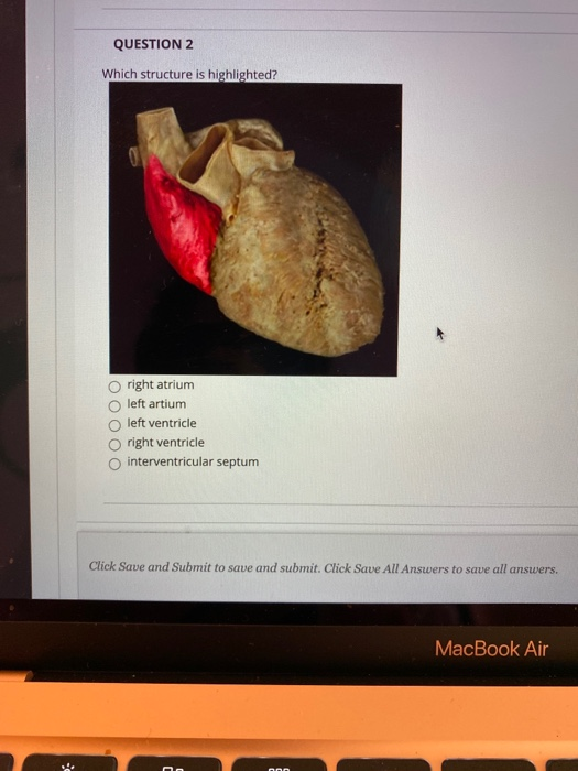 Solved QUESTION 2 Which structure is highlighted? right | Chegg.com