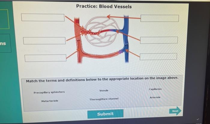 Solved Practice: Blood Vessels ms Match the terms and | Chegg.com