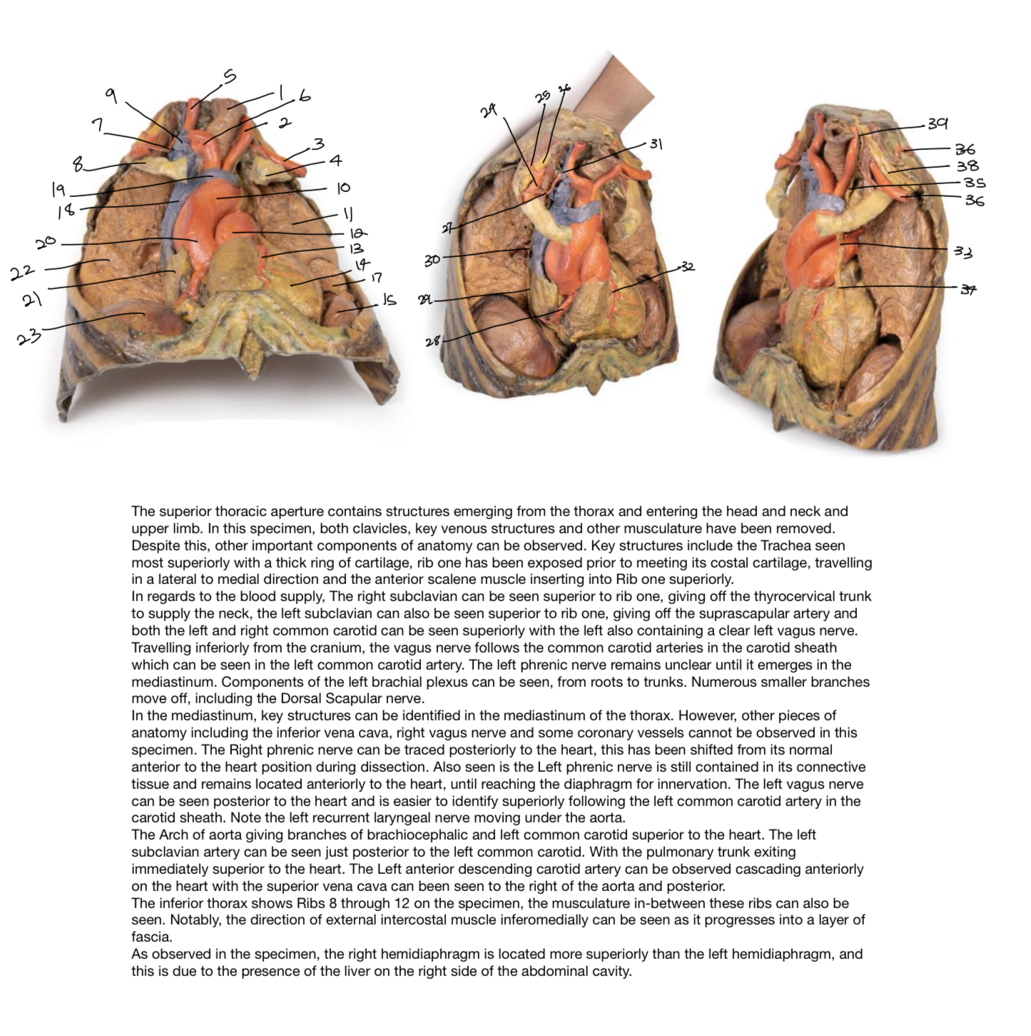 Solved Can you label the image below with the features | Chegg.com