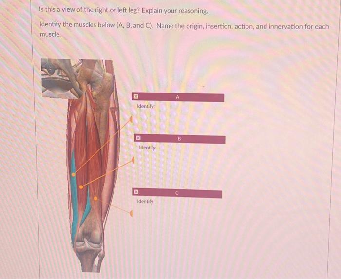 Solved Is this a view of the right or left leg? Explain your | Chegg.com