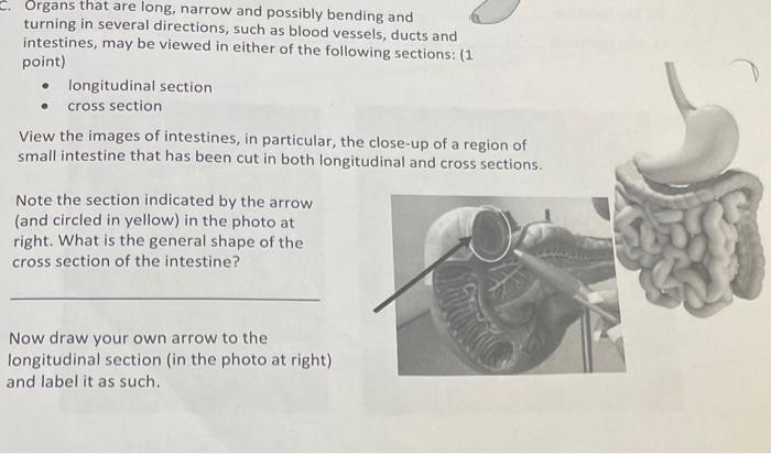Solved View the images of intestines, in particular, the | Chegg.com