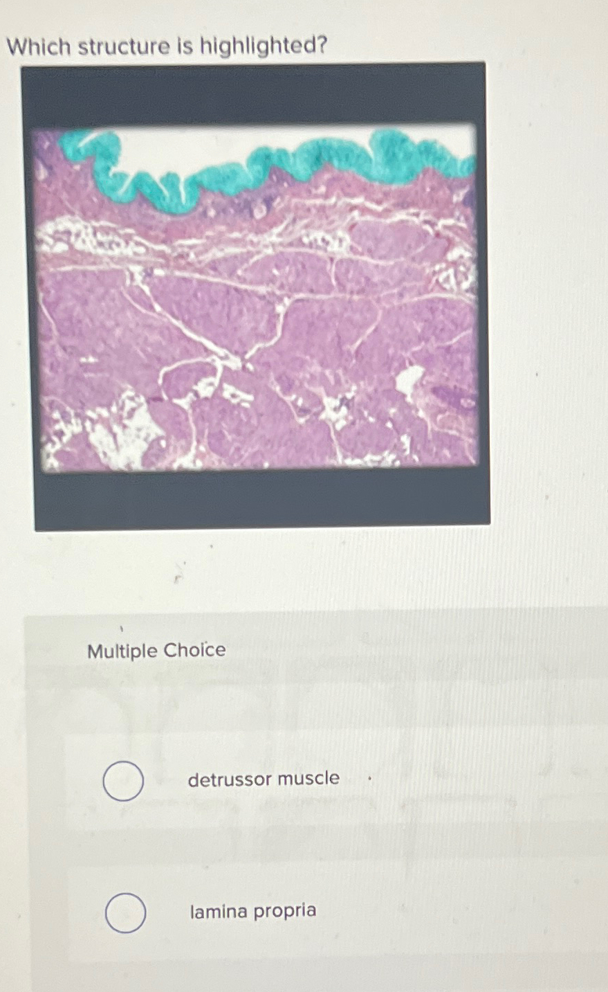 Solved Which structure is highlighted?Multiple Choice | Chegg.com