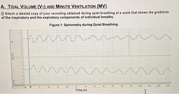 Solved using this graph: 1. what is the inspiratory flow | Chegg.com