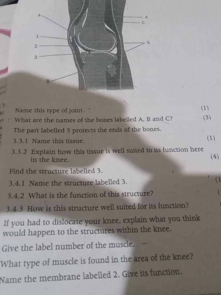 Solved Name this type of joint.(1)What are the names of the | Chegg.com