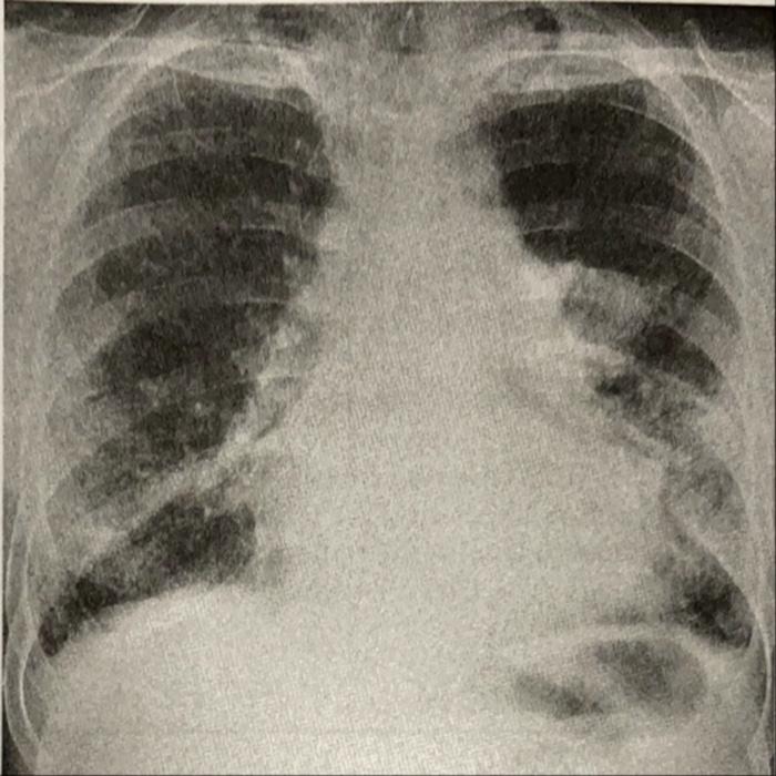 Solved ADMITTING HISTORY | Chegg.com