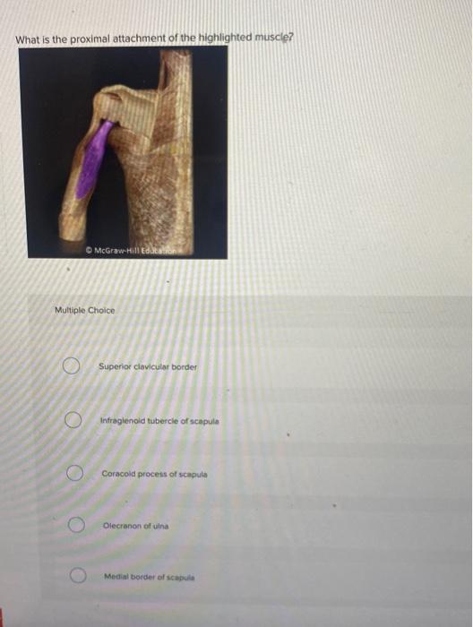 What is the proximal attachment of the highlighted | Chegg.com