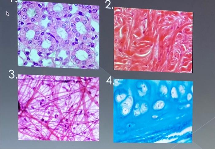 Solved 9. Tissue indicated by the pointer 10. 11. | Chegg.com