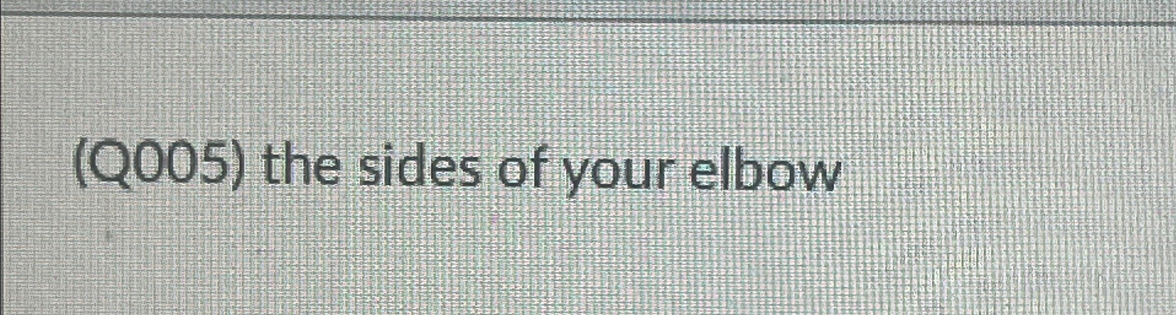 (Q005) ﻿the sides of your elbow | Chegg.com