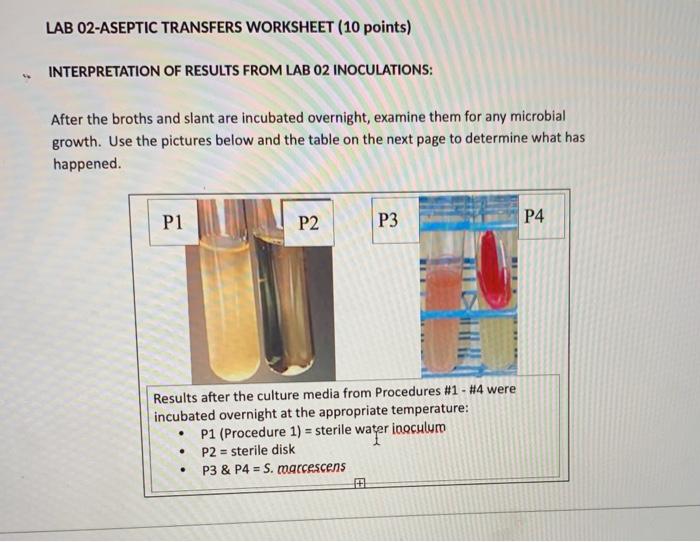 Solved LAB 02-ASEPTIC TRANSFERS WORKSHEET (10 points) | Chegg.com