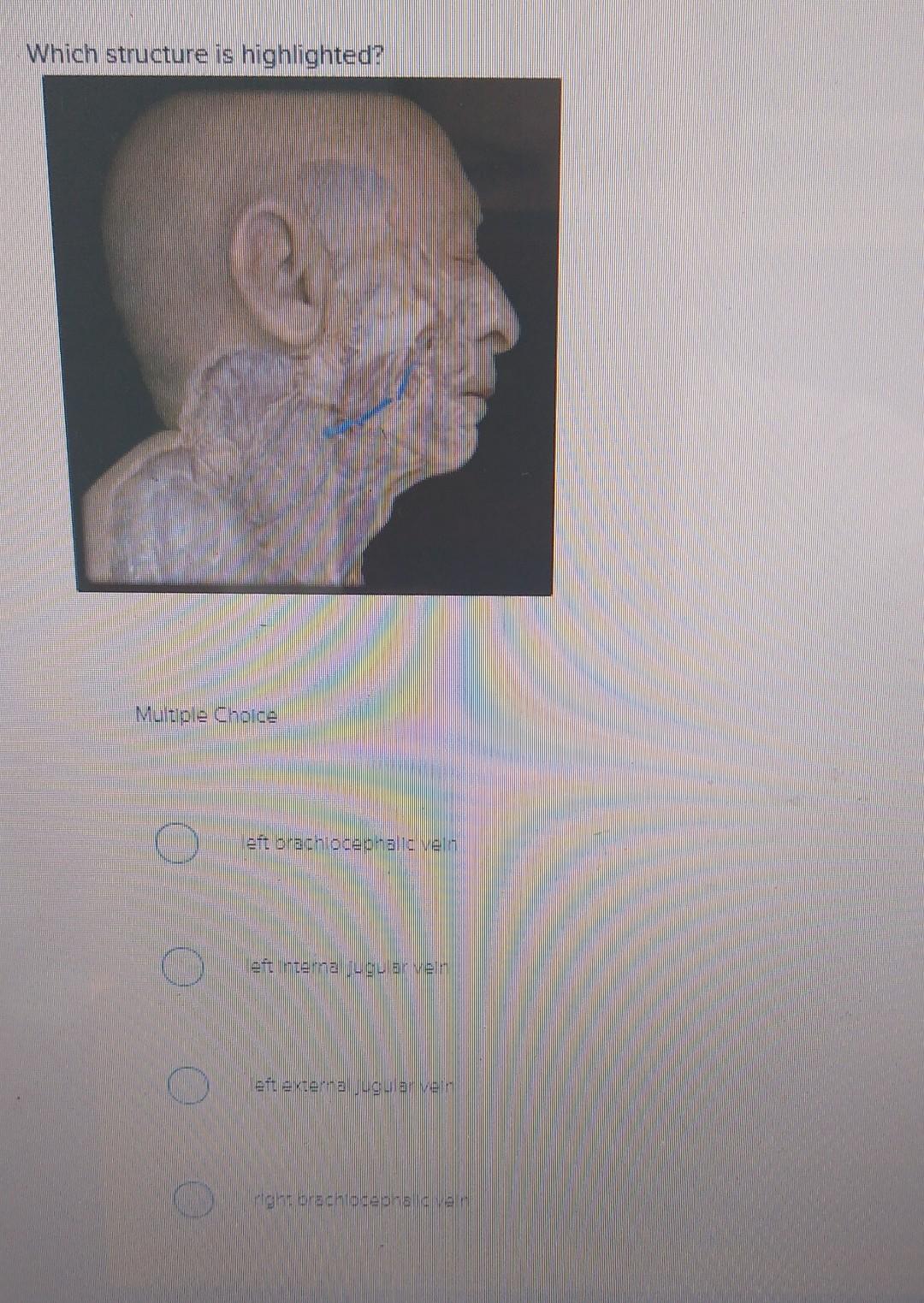 Solved Which structure is highlighted? Multiple Choice eft | Chegg.com