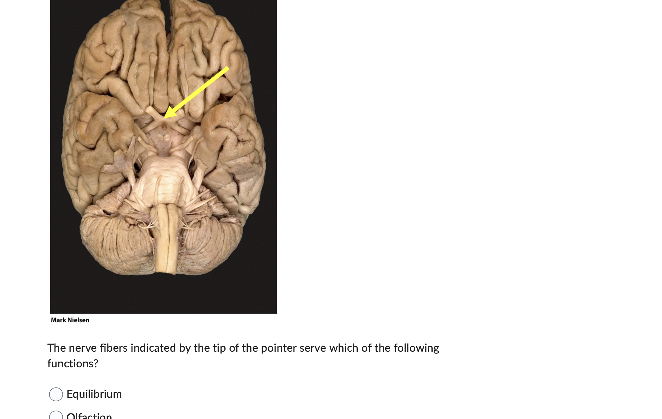 Solved Mark NielsenThe nerve fibers indicated by the tip of | Chegg.com