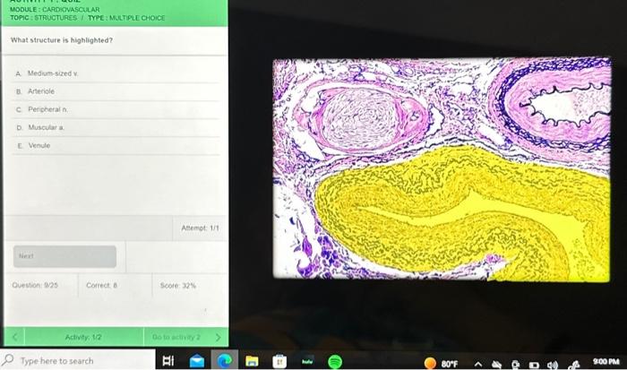 Solved MODULE : CAPOEKVASCLLAR -TOPIC : STRUCTURES I TYPE: | Chegg.com