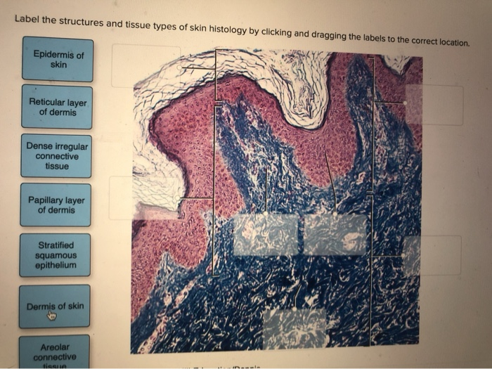 Solved Label the structures and tissue types of skin | Chegg.com