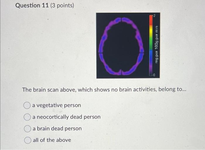 Question 11 (3 points) The brain scan above, which | Chegg.com
