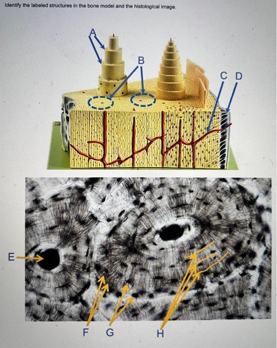 Solved Identify the label structures in the bone model and | Chegg.com