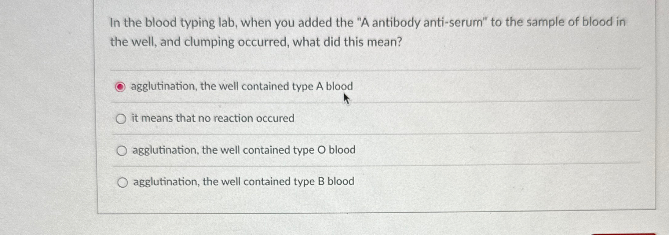 Solved In the blood typing lab, when you added the "A | Chegg.com
