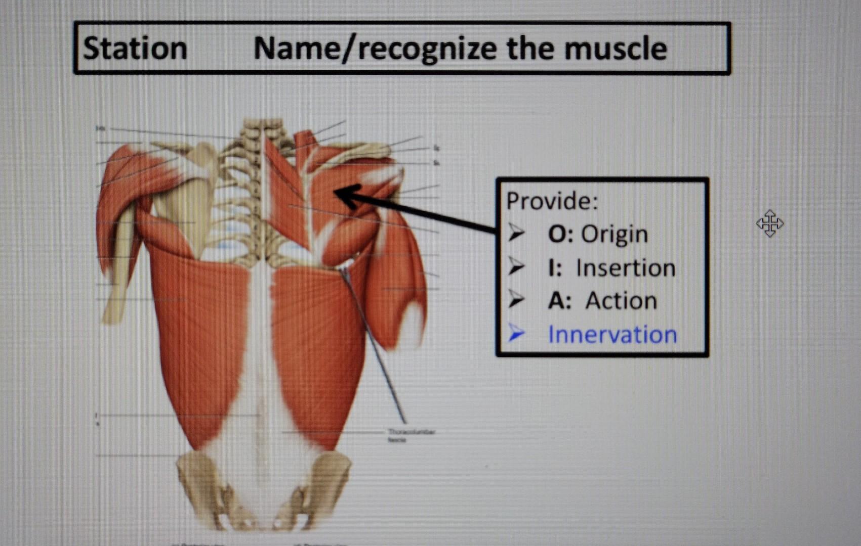 Solved Station Name/recognize the muscle cansin | Chegg.com