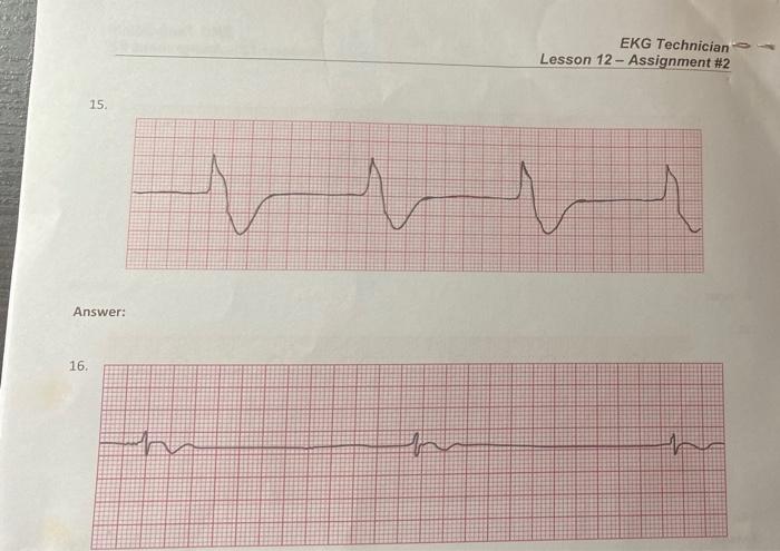 Solved Lesson 12 Assignment #2: Basic EKG Interpretation | Chegg.com