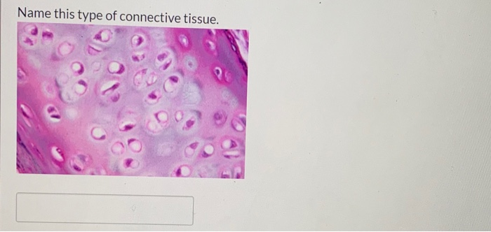 Solved Cells (pointer tip) that make the protein fibers of | Chegg.com