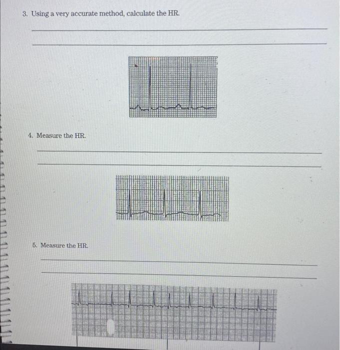 Solved Normal Ranges for Selected ECG Parameters Quiz 1 1. | Chegg.com