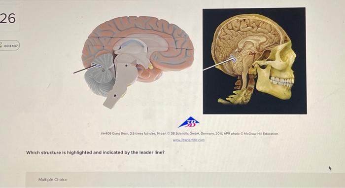 Solved Which structure is highlighted and indicated by the | Chegg.com