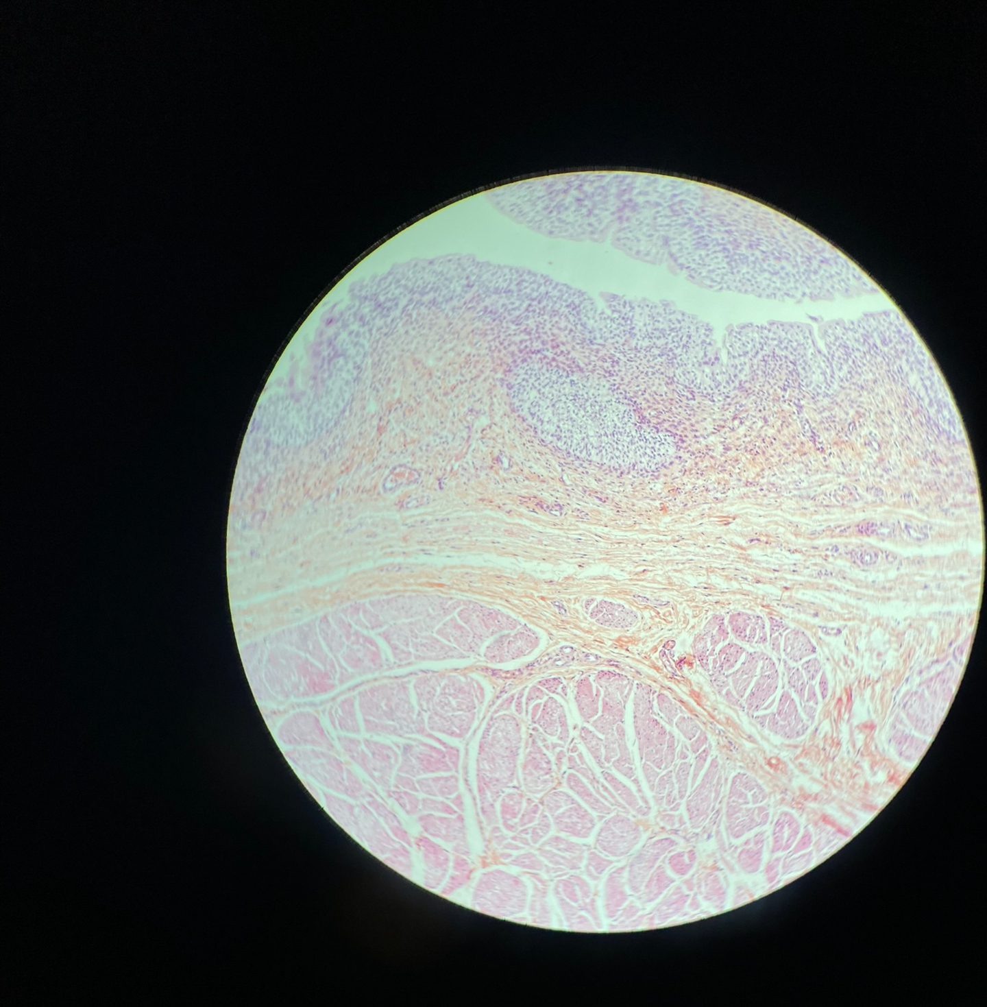 Solved Please label Transitional epithelium (a) | Chegg.com