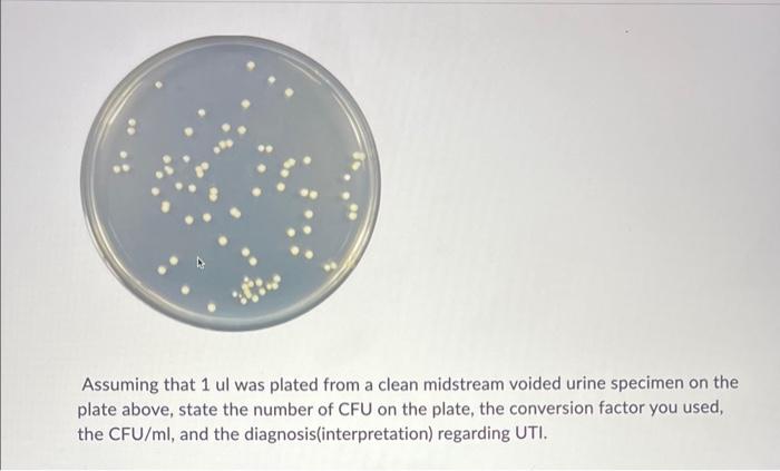 Solved Assuming that 1 ul was plated from a clean midstream | Chegg.com
