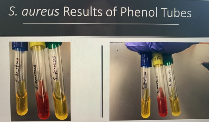 Solved Results 1. Carbohydrate Fermentation Record your | Chegg.com
