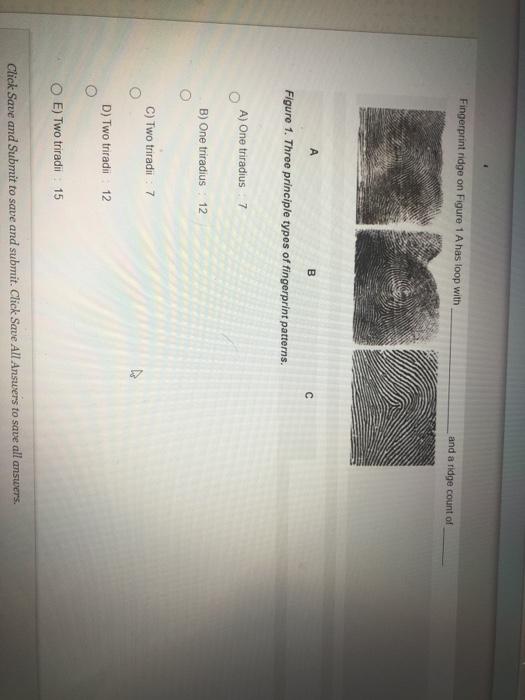 Solved Fingerprint ridge on Figure 1 A has loop with and a | Chegg.com