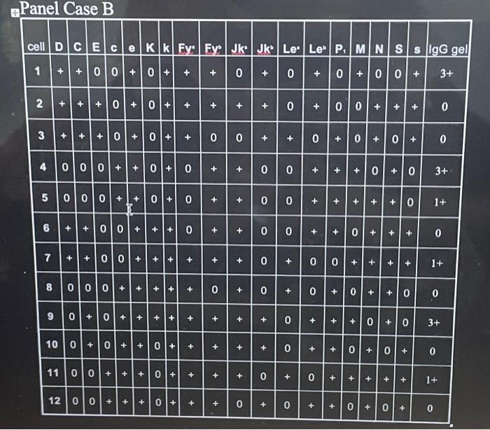 Solved Panel Case B | Chegg.com