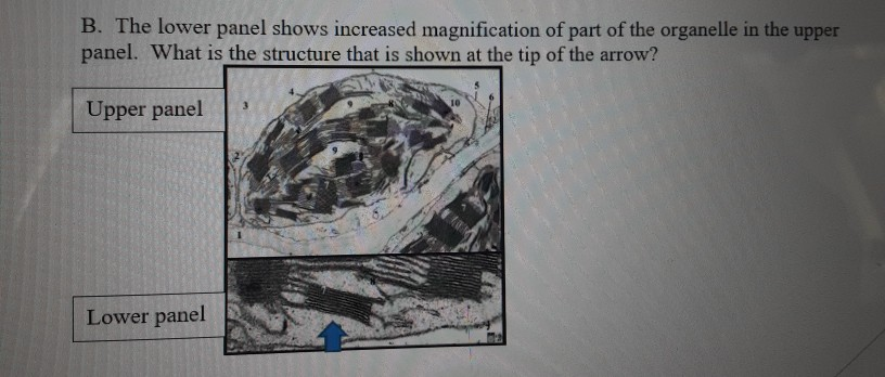 Solved B. The lower panel shows increased magnification of | Chegg.com