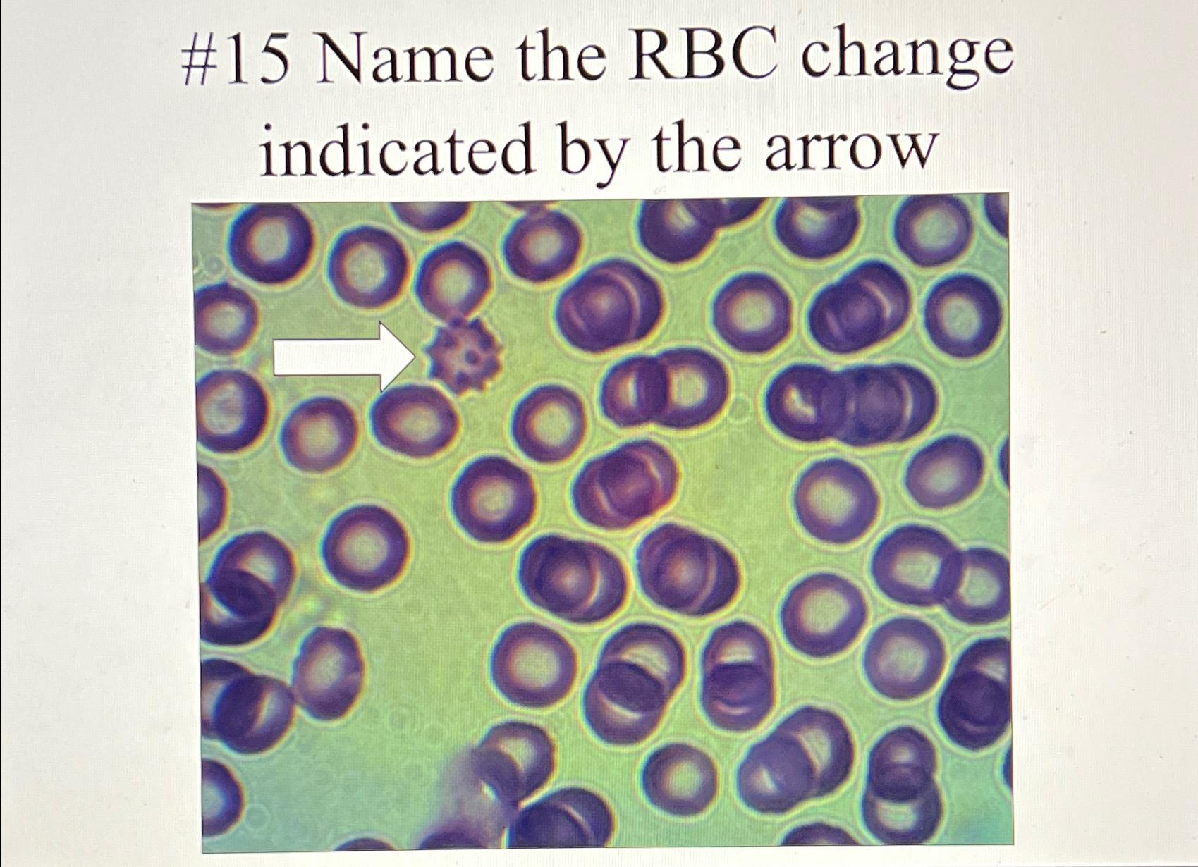 Solved #15 ﻿Name the RBC change indicated by the arrow | Chegg.com