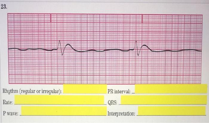 Solved 23. Rhythm (regular or irregular): PR interval: Rate: | Chegg.com