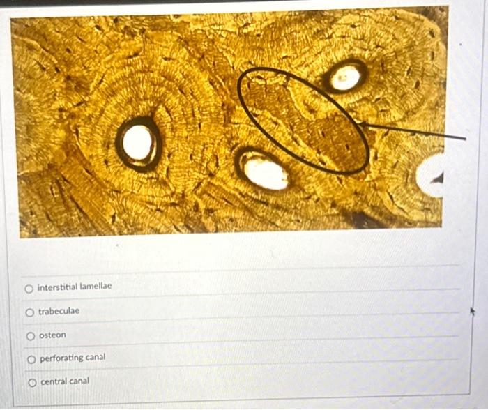 Solved interstitial lamellae trabeculae osteon perforating | Chegg.com