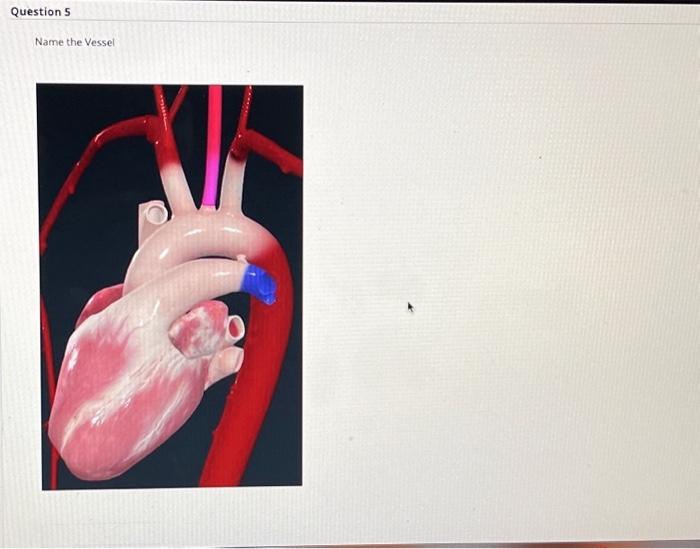 Solved Name the Vessel | Chegg.com