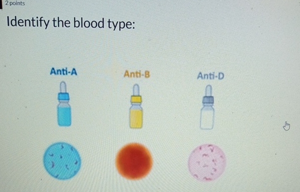 Solved 2 ﻿pointsIdentify the blood type:Anti-AAnti-BAnti-D | Chegg.com