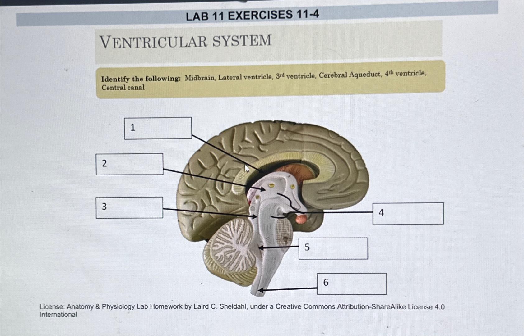 Solved LAB 11 ﻿EXERCISES 11-4VENTRICULAR SYSTEMIdentify the | Chegg.com