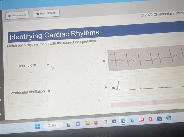 Match each rhythm image with the correct | Chegg.com