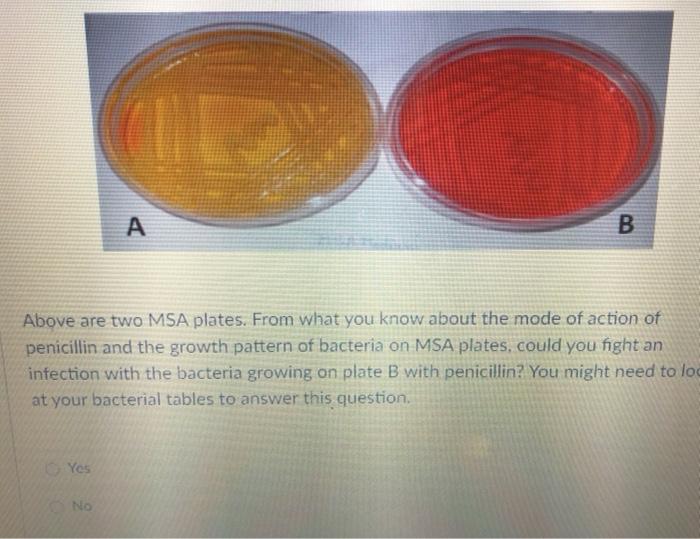 Solved A B Above are two MSA plates. From what you know | Chegg.com