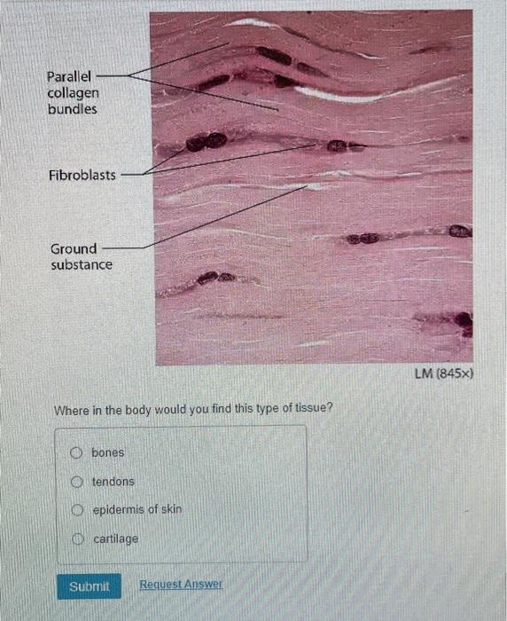 Solved Parallel collagen bundles Fibroblasts Ground | Chegg.com