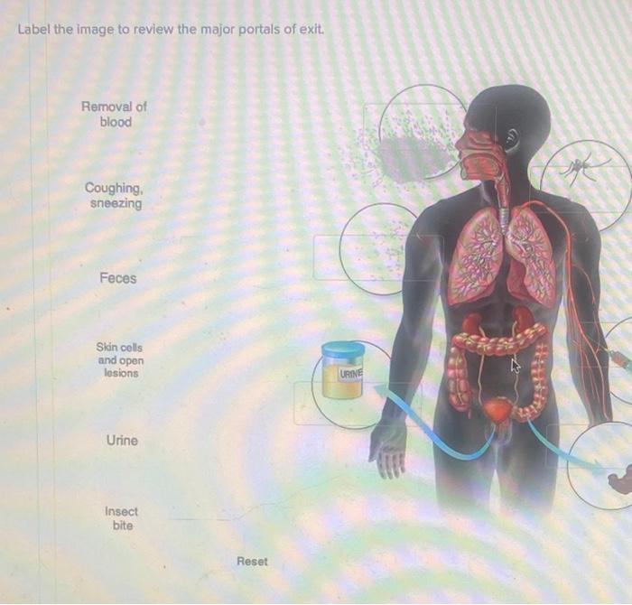 Solved Label the images to examine patterns of infectious | Chegg.com
