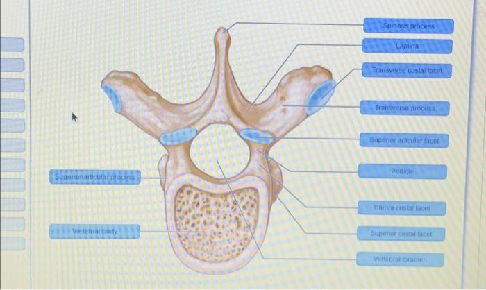 Solved *urgent | Chegg.com
